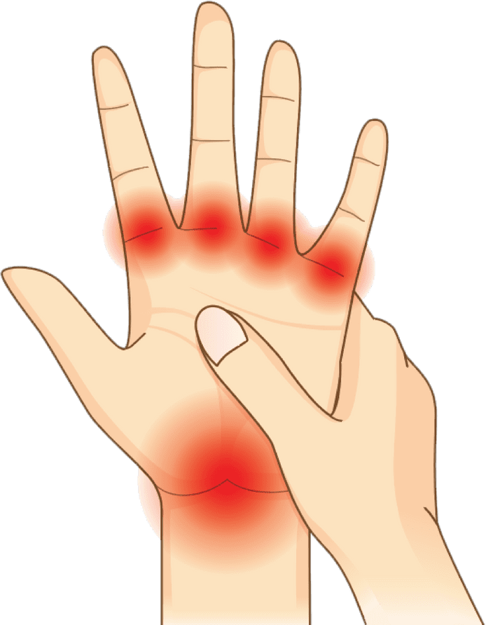 A Patient’s Guide to Understanding Rheumatoid Arthritis Pain