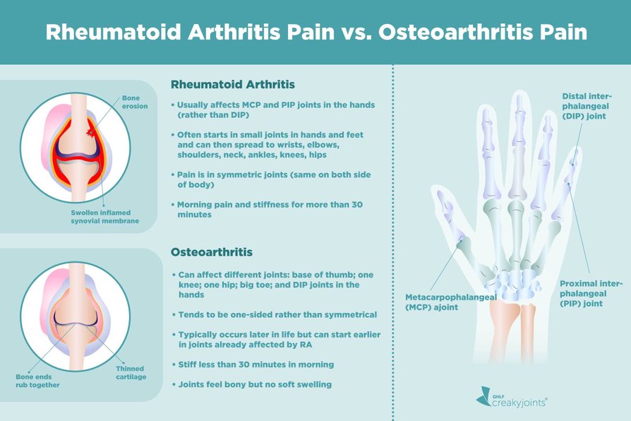 A Patient’s Guide to Understanding Rheumatoid Arthritis Pain