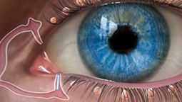 DryEye Rescue Clinics - Advanced Dry Eye Treatments in one location.