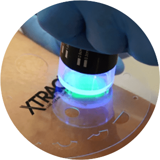 XTRAC Laser Psoriasis Treatment