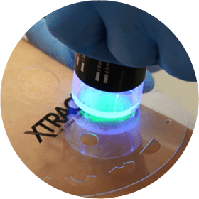 XTRAC Laser Psoriasis Treatment