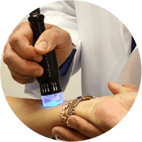 XTRAC Laser Psoriasis Treatment