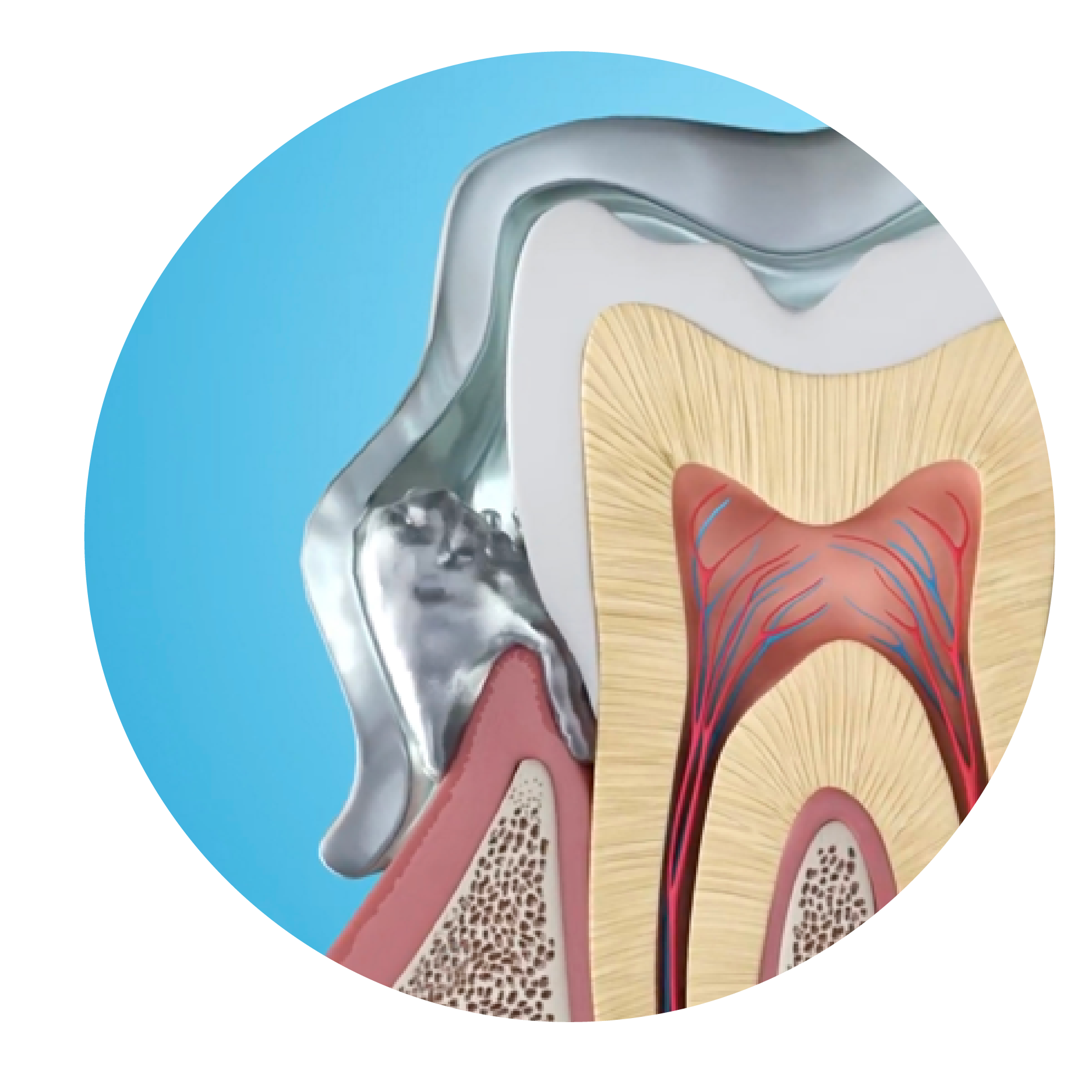 Deep Impact - Perio Restore