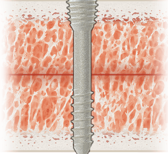 Experience the OSSIO Difference