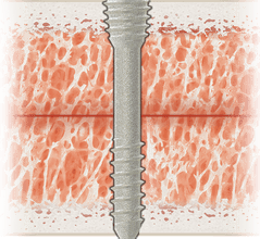 Experience the OSSIO Difference