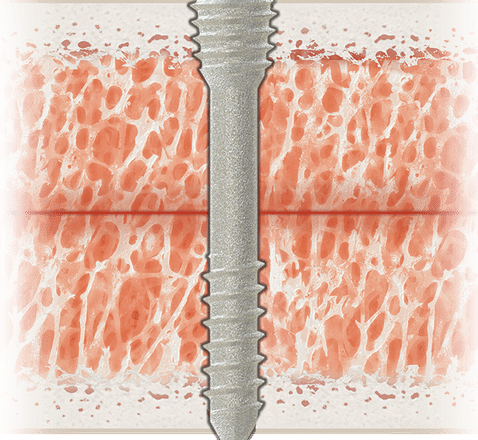 Experience the OSSIO Difference