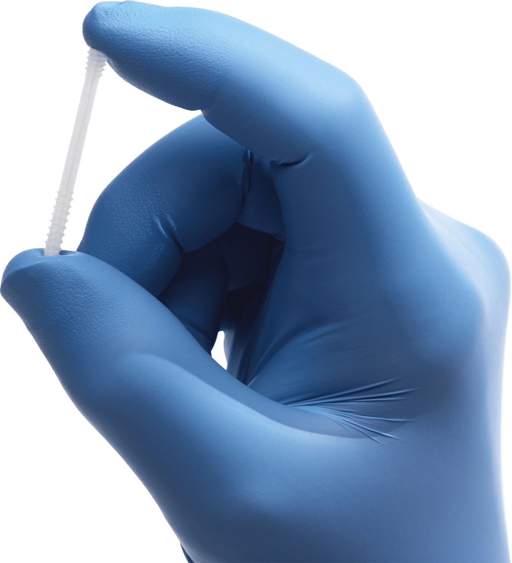 Micro-CT scan at six months of OSSIO fiber ® Compression Screws in an ...