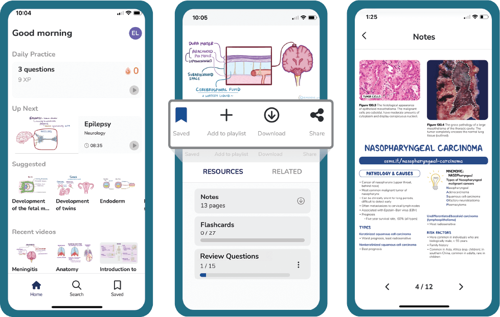 Medical Illustrated Video Explainers For Teaching Students | Osmosis