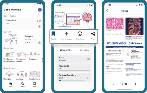 Illustrated Video Explainers For Teaching Nurse Practitioner Students | Osmosis