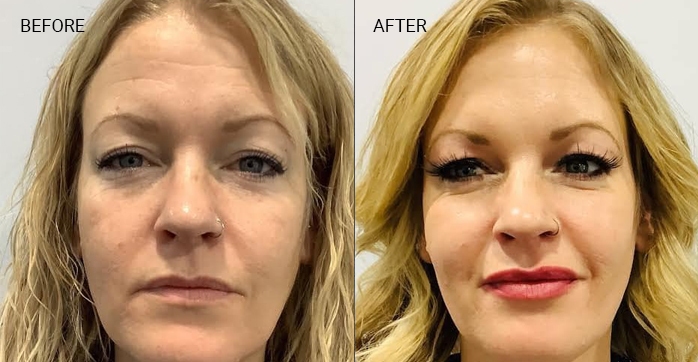 Garden State Medical Spa I Botox