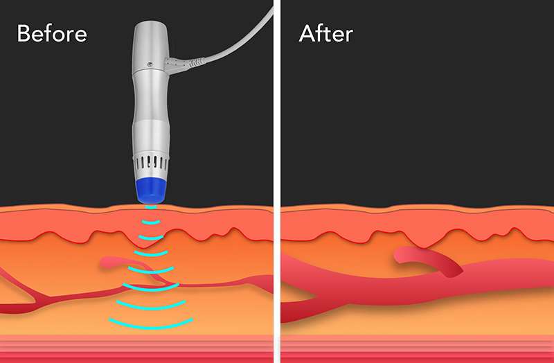 Boston Medical Group | Men's Health Specialist | ED Treatments