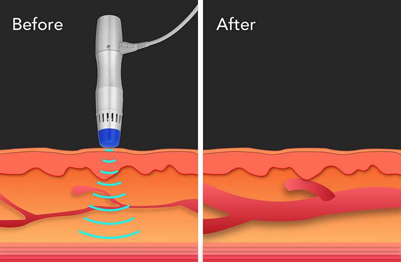 Boston Medical Group | Men's Health Specialist | ED Treatments