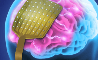 NeuroOne | Turning Brain Signals into Actionable Solutions