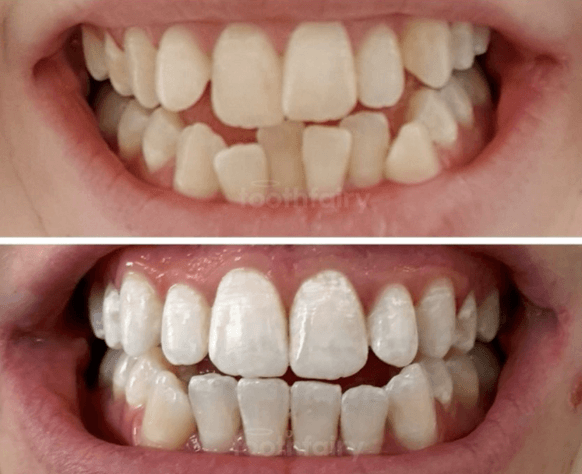 Issue solved: Crowding