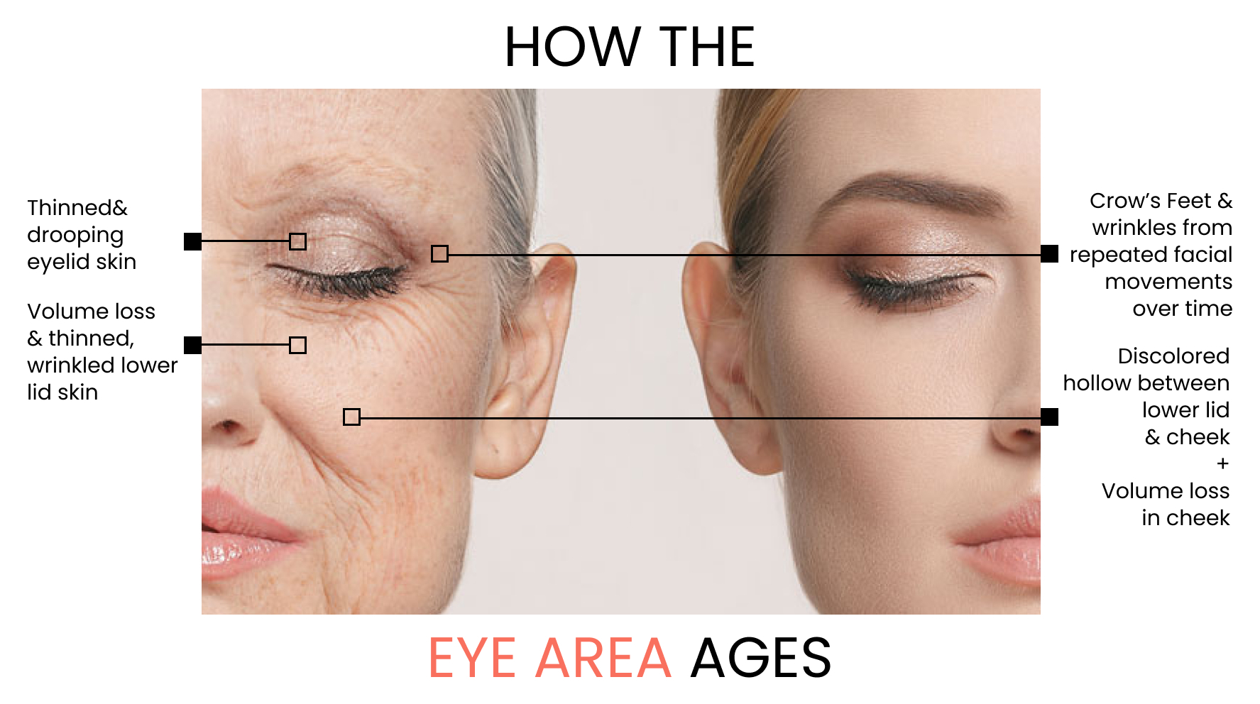 Brighten the look of dark circles