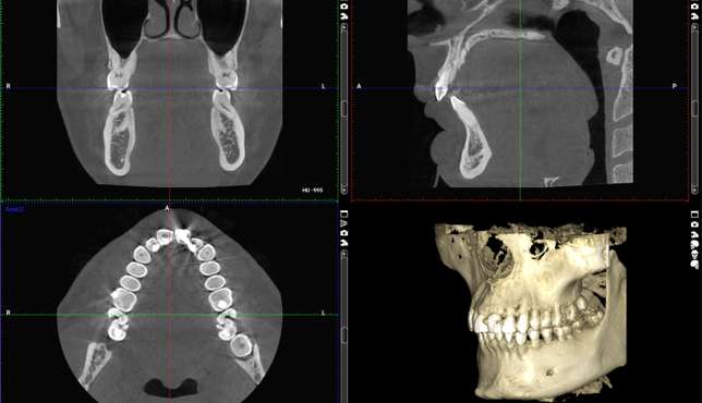 Planmeca Viso family of CBCT 3D imaging systems