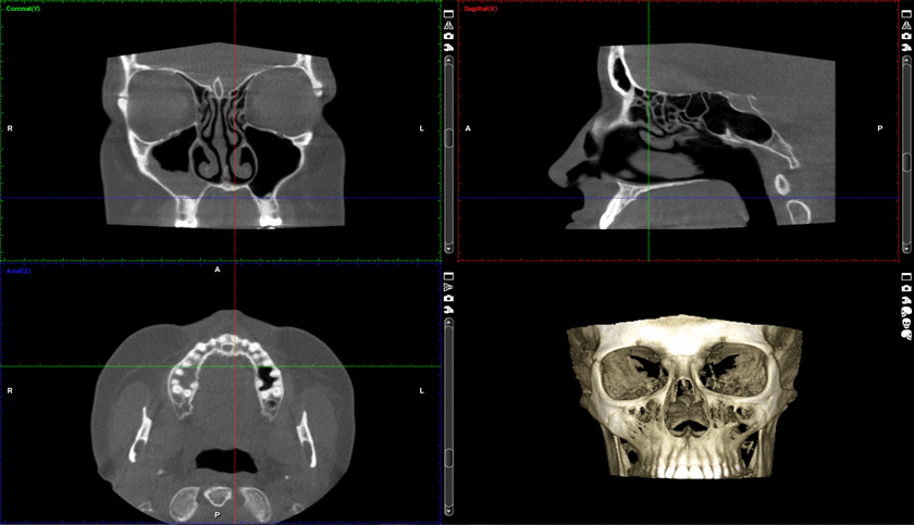 Planmeca Viso family of CBCT 3D imaging systems