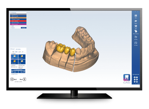 Planmeca Planmill 50S dental chairside mill