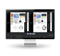 Glaucoma Management Suite | Topcon Healthcare