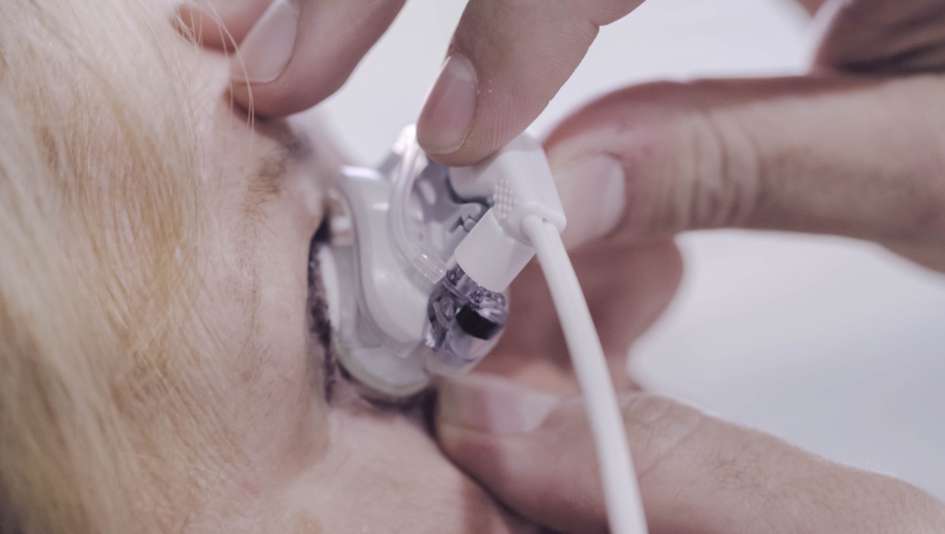 Limited Time Offer: 50% Off LipiFlow® Dry Eye Treatment | Dry Eye ...