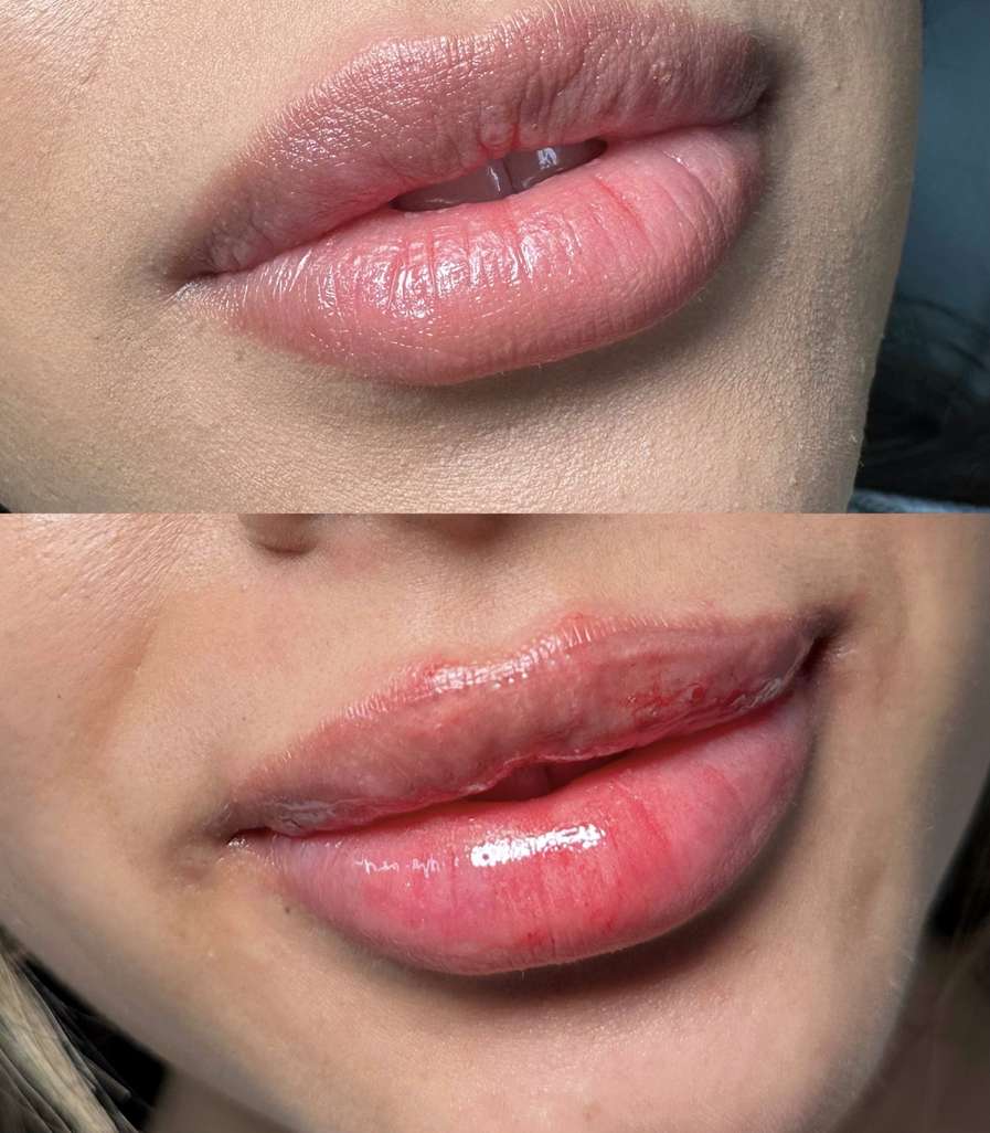 Evolysse at Modern Aesthetics and Wellness