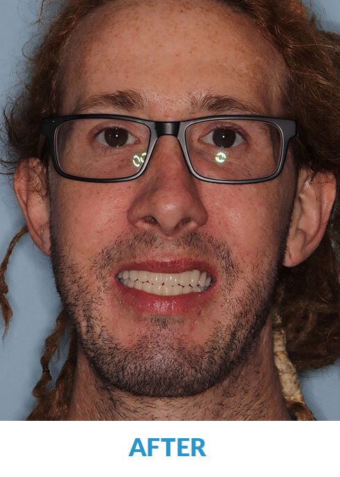 Next Step Smiles Dental Implant Center