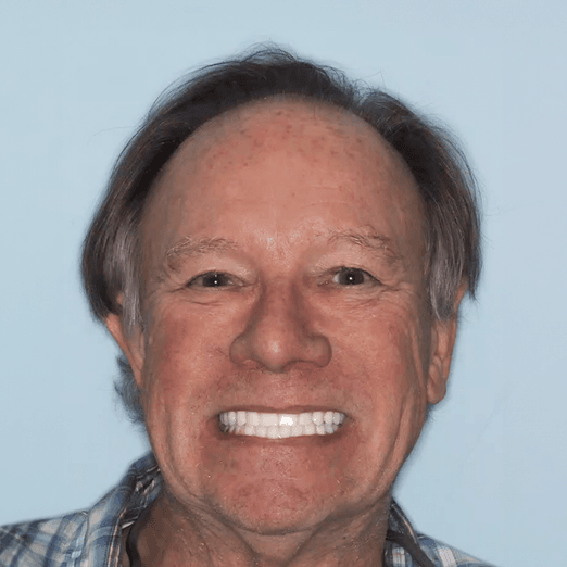 Next Step Smiles Dental Implant Center