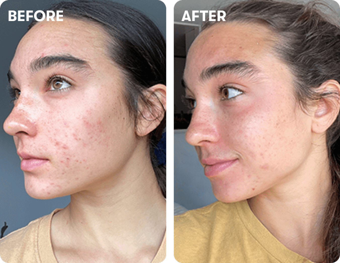 Clear Skin, Clear Results