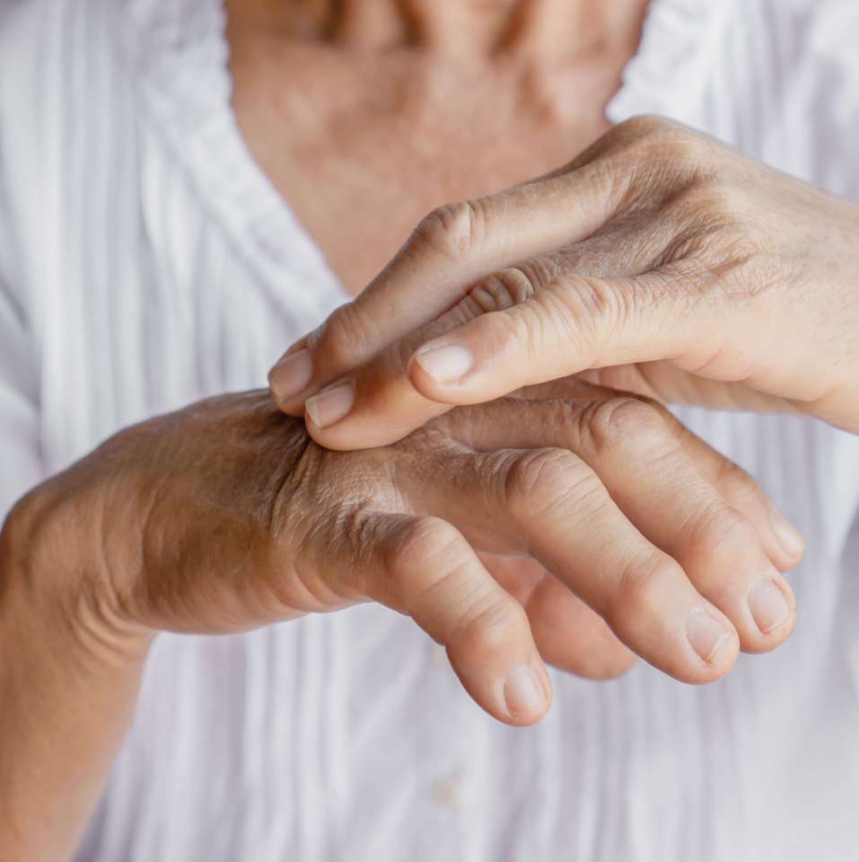 How to use ACV to ease the burning pain and swelling of gout!