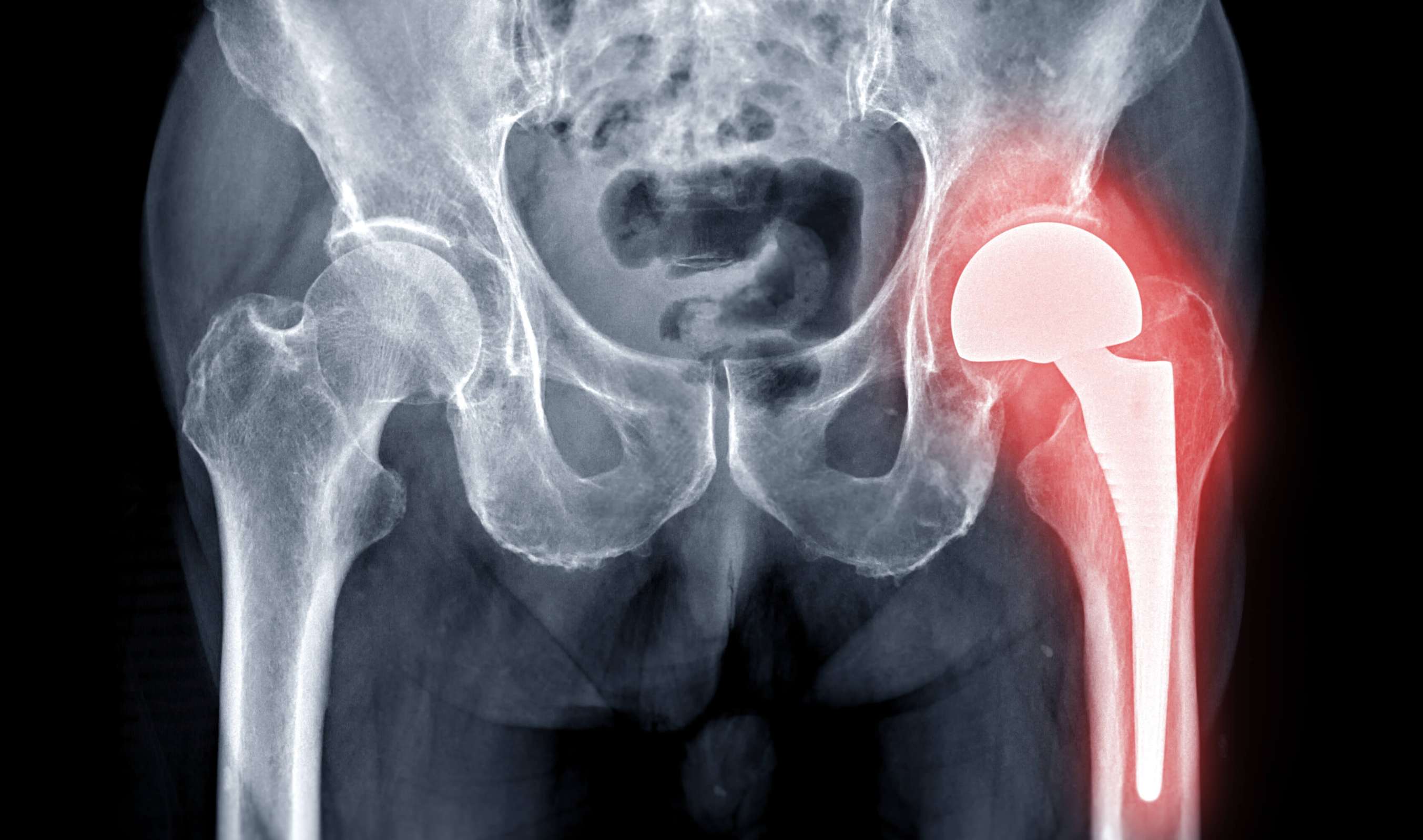 And then…injections.