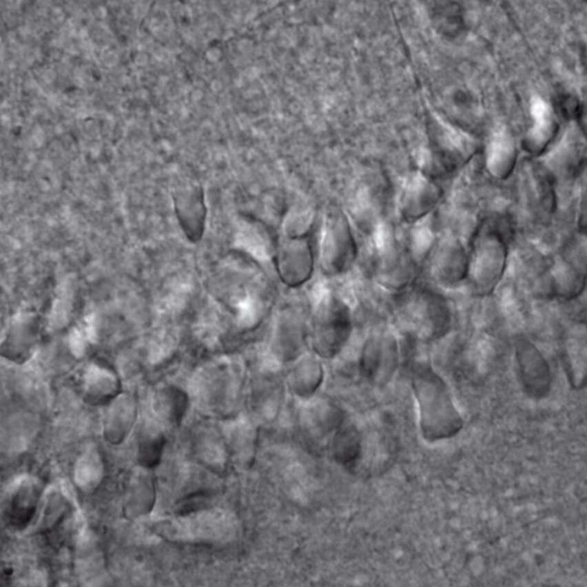 Acute Brain Slice Free Step-By-Step Guide