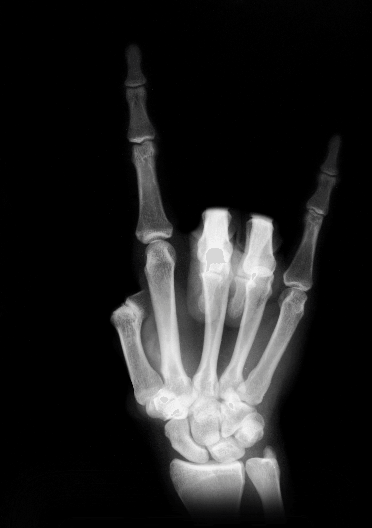 Halifax Health is Rad