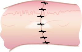 Dr. David S. Wilson | $2,500 Vasectomy Reversal | The Reversal Clinic