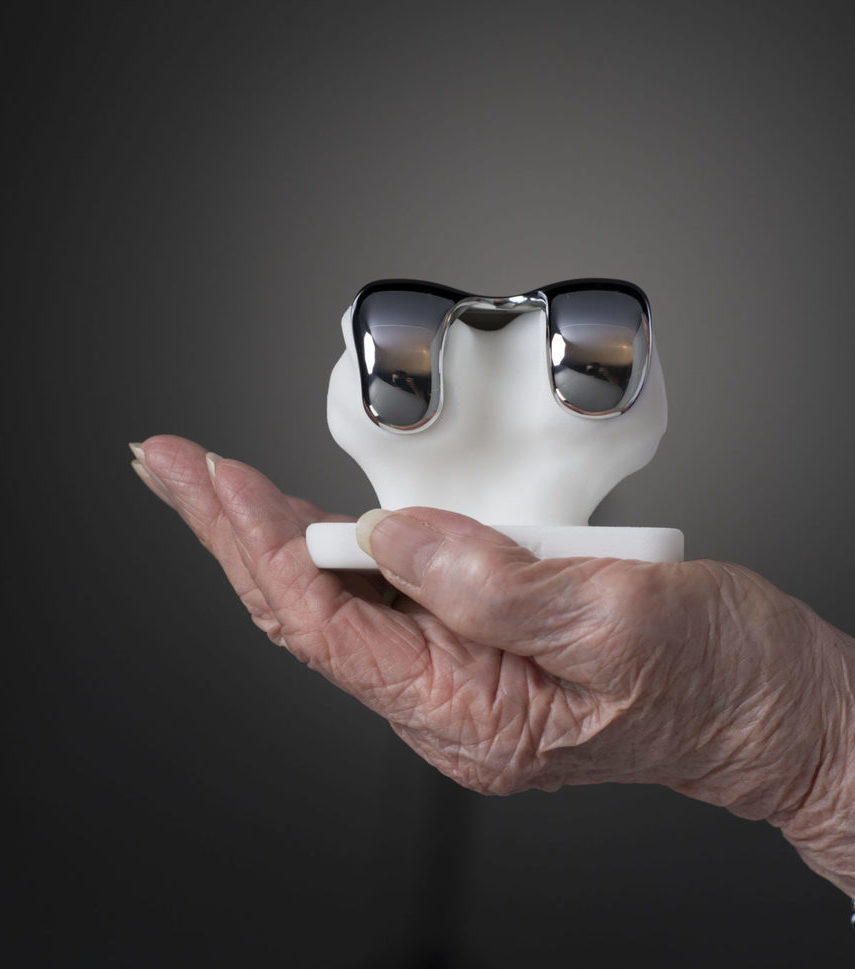 Conformis Bone Models