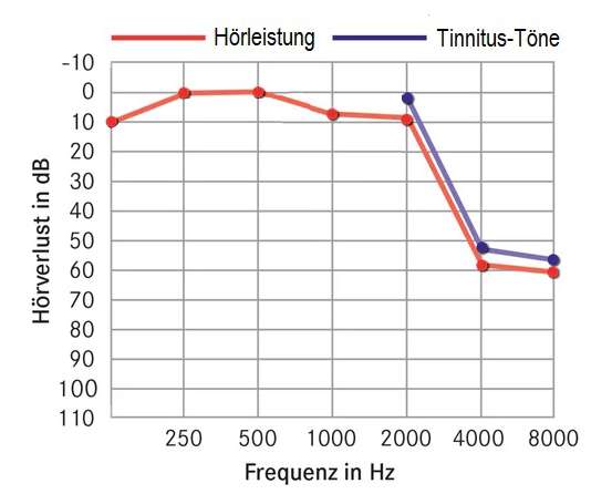 * https://www.ncbi.nlm.nih.gov/pmc/articles/PMC9560716/
