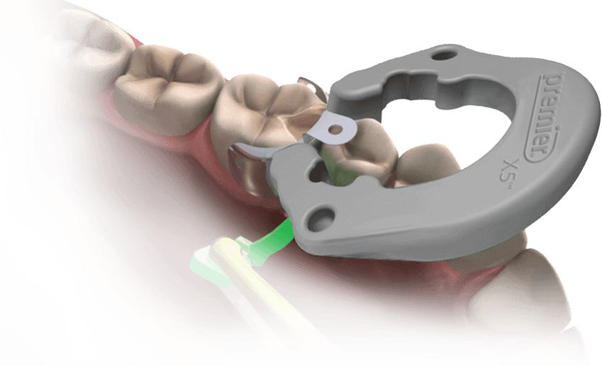 Premier X5 Sectional Matrix System - Try it for yourself
