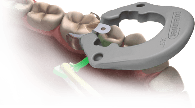 Premier X5 Sectional Matrix System - Try it for yourself