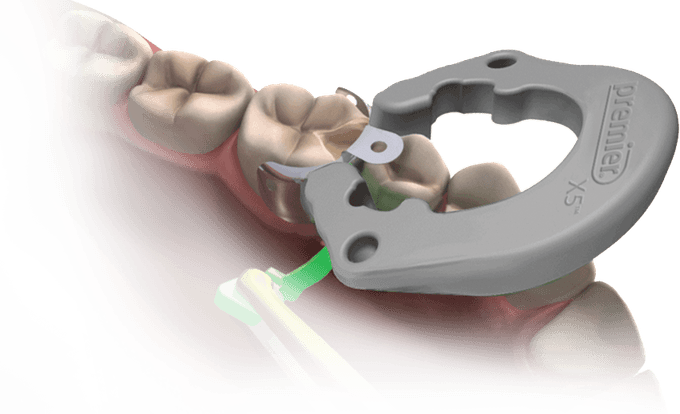 Premier X5 Sectional Matrix System - Try it for yourself