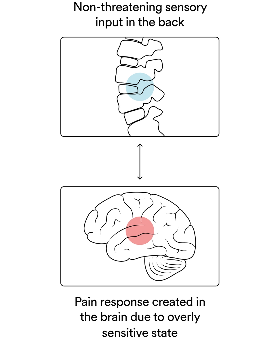 Relio: Back Pain Management