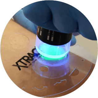 XTRAC Laser Psoriasis Treatment